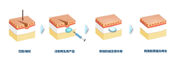 聚己内酯PCL：医疗与医美领域的“温柔革命者”-材料干货|Chatplas|塑料在线