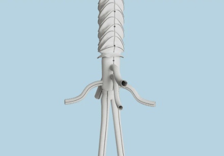 人工血管行业解读：从材料到临床应用及市场前景-大厂动态|Chatplas|塑料在线